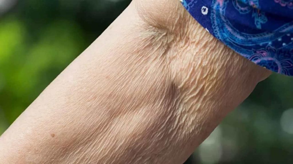 Pelle cadente, come renderla tonica con questo semplice rimedio naturale